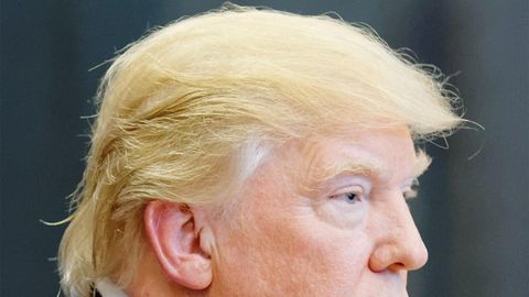 El secreto del cabello de Donald Trump, ¿un trasplante capilar?