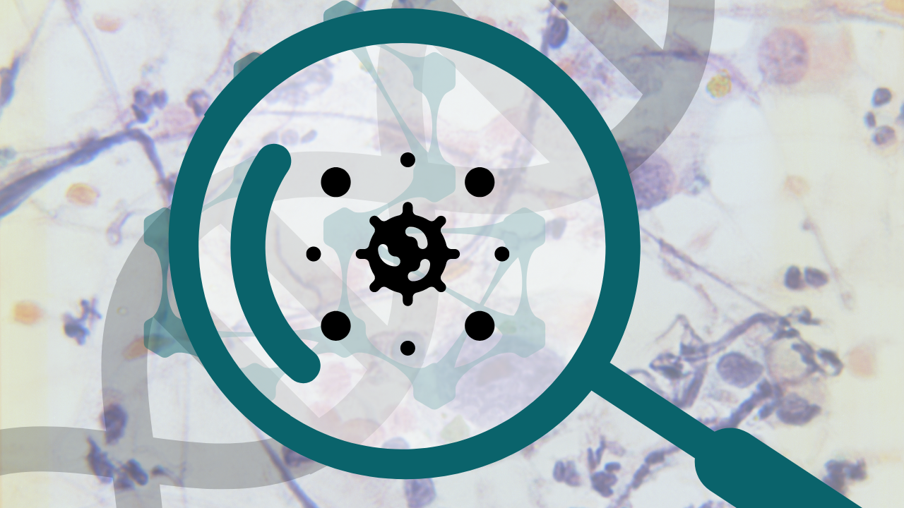 Así es la metástasis: «El ambiente ayuda al tumor a seguir creciendo»