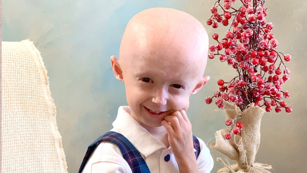 Esther, madre de la única niña de España que sufre progeria: «Nunca ...