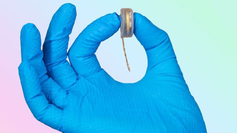 Elon Musk afirma que en seis meses podría implantar los chips ...