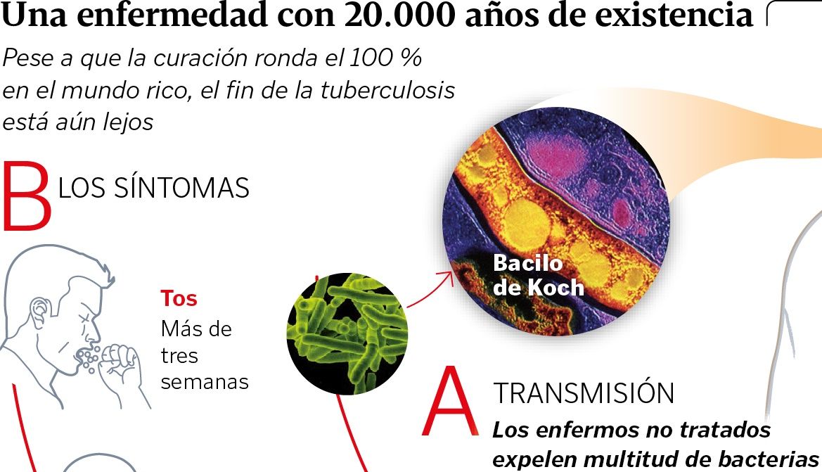Un brote de tuberculosis en Camariñas deja 12 afectados y unos 500 ...