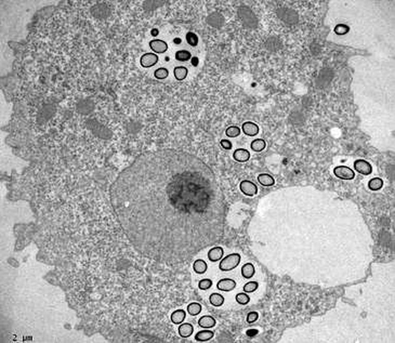 El hallazgo de un virus de tamaño gigante sorprende a los científicos